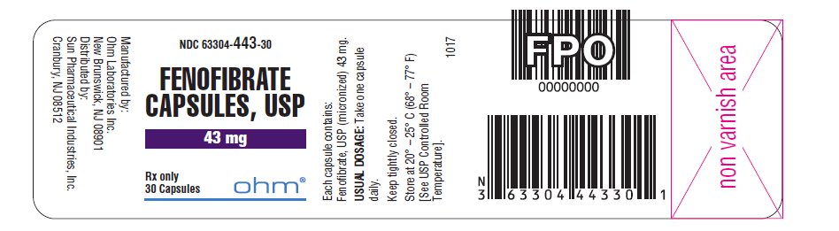 Rx Item-Fenofibrate 43MG 30 Cap by Sun Pharma USA Gen Antara