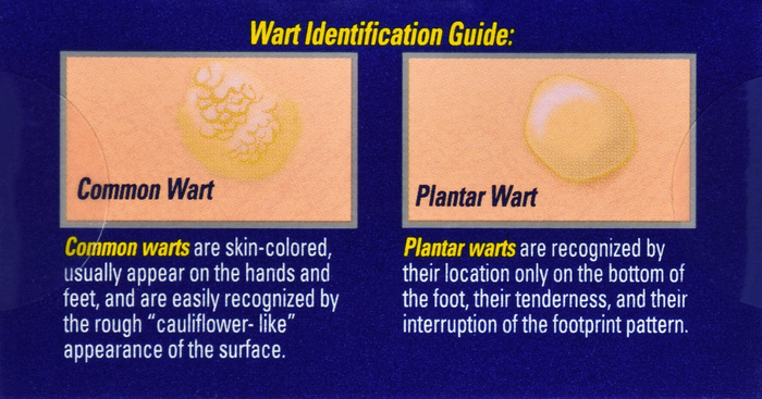 Compound W Complete Wart Kit By Medtech